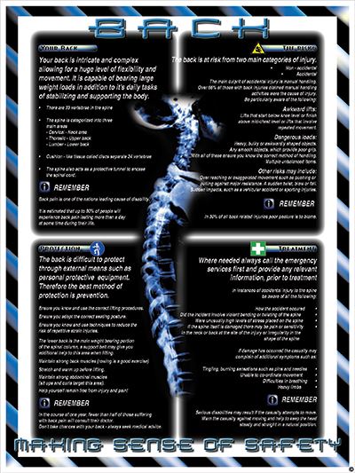 Making Sense Of Safety – Back Protection Poster | Allsigns